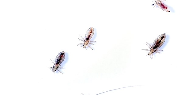 4 Tips for Dealing with Pubic Lice